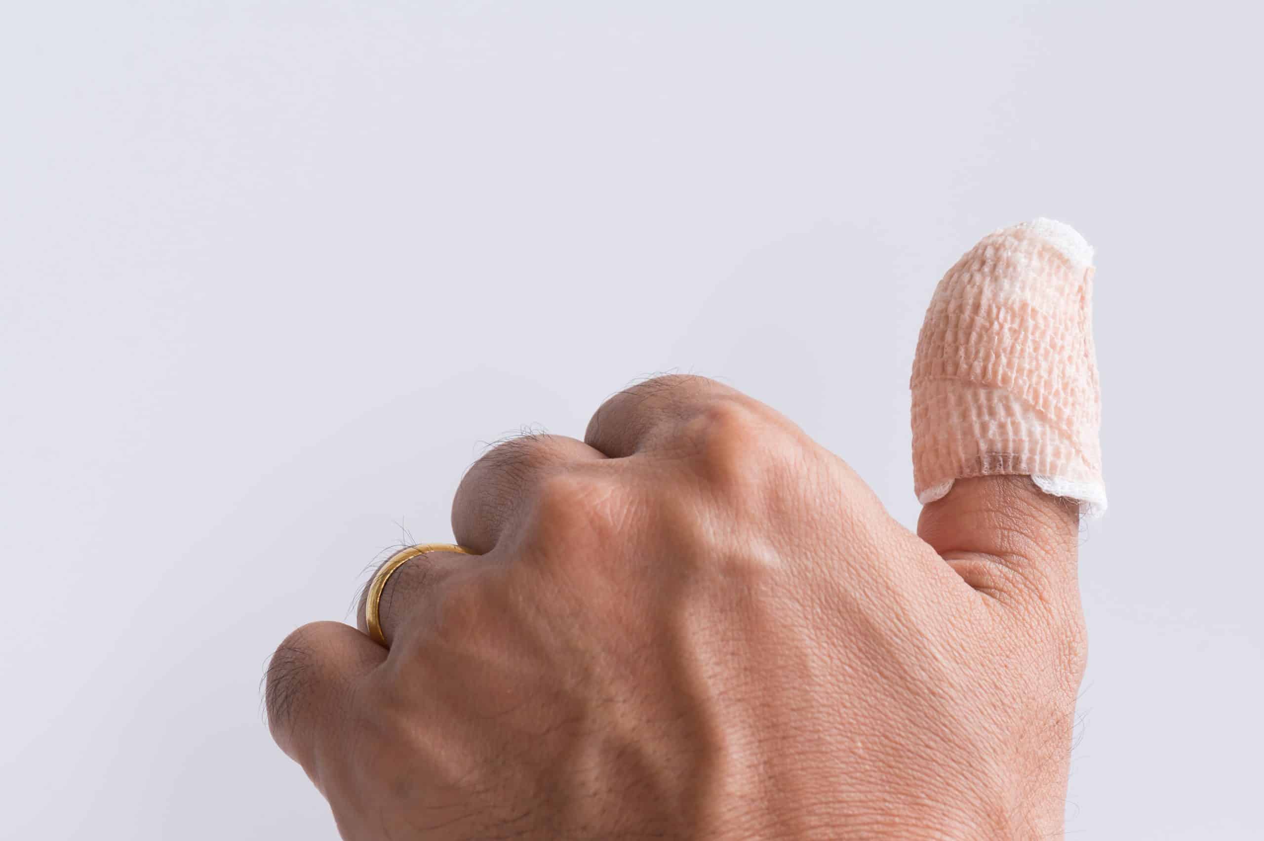 Kako izvući gnoj iz prsta - Kolosej.rs